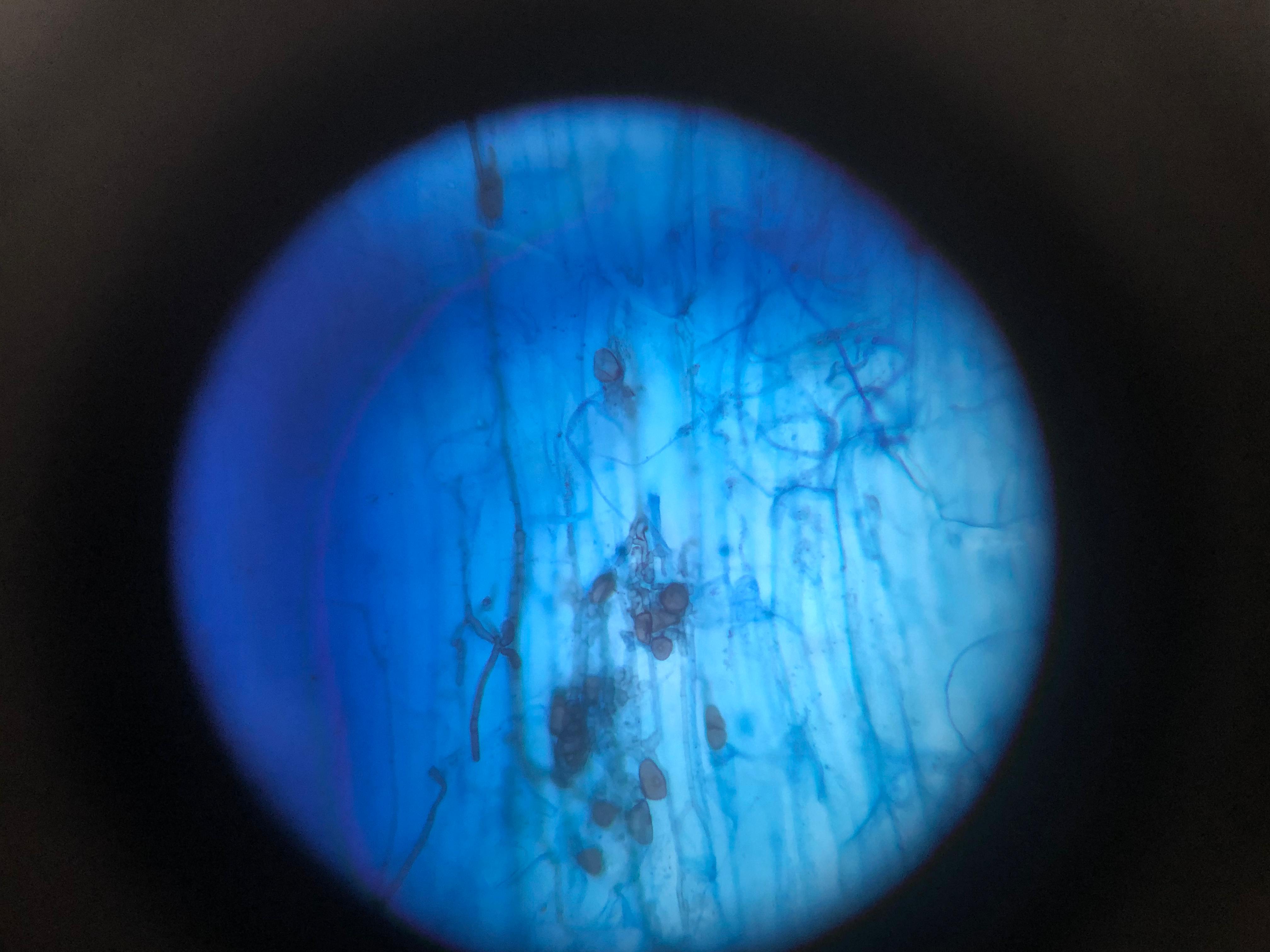 Arbuscular Mycorrhizal Fungi: Unveiling Nature's Underground Network